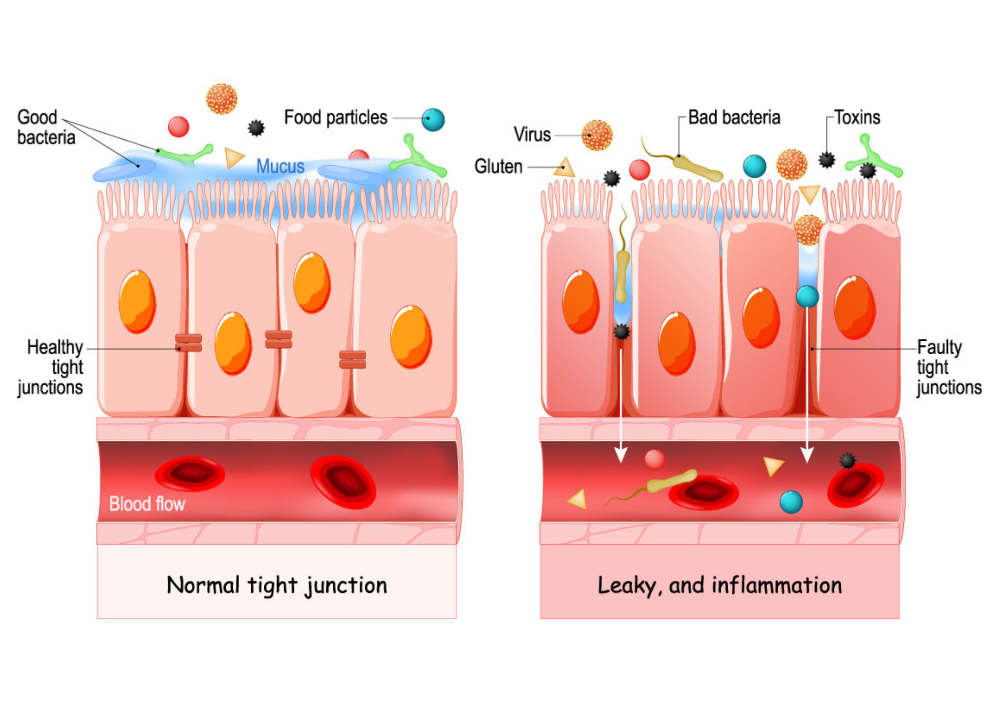 Podcast Episode Covers (6) | Katie Stewart | Acne Nutritionist